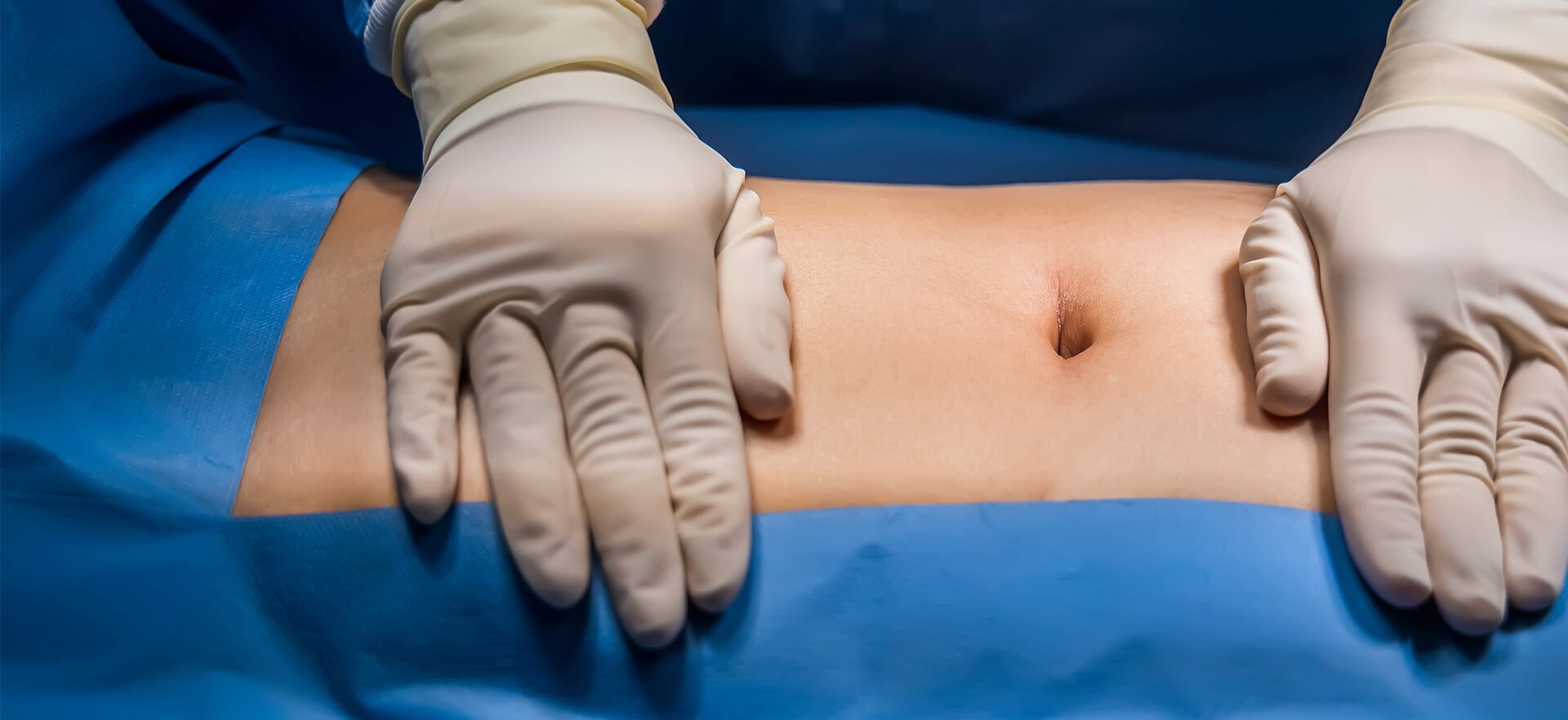 Hernia Repair Procedures: Open and Laparoscopic Surgery Options