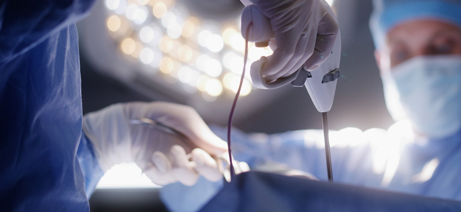 Understanding Laparoscopy: Diagnostic Surgery for Abdominal Pain
